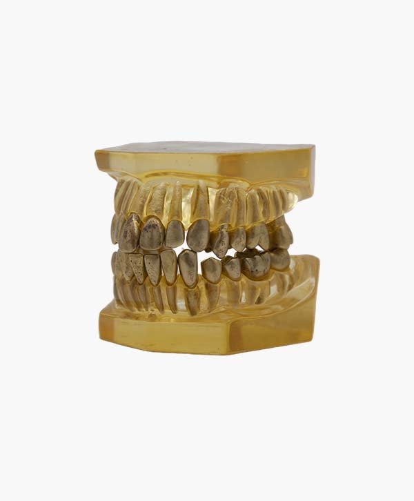 Tooth Extraction and Orthodontic Training Model - Feiman