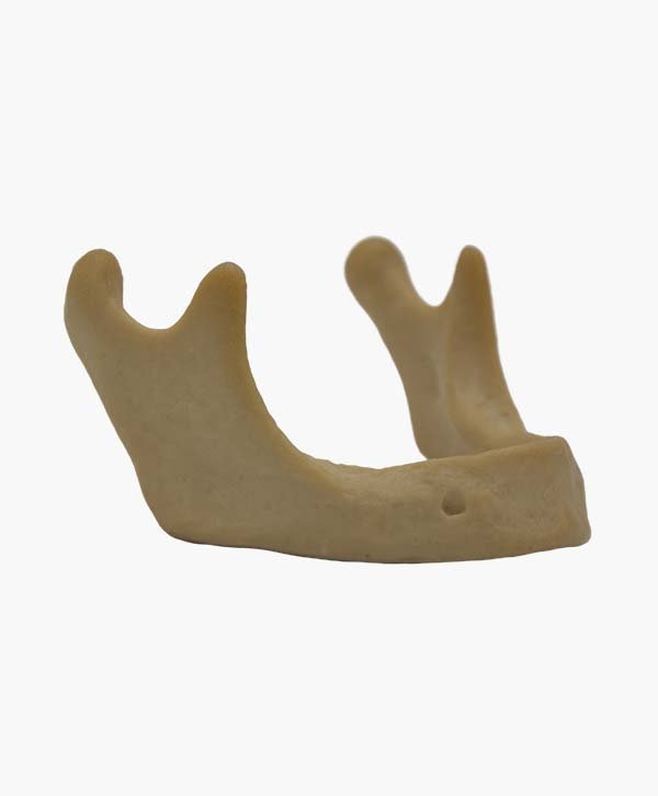 Simulation Mandibular Bone B - Feiman