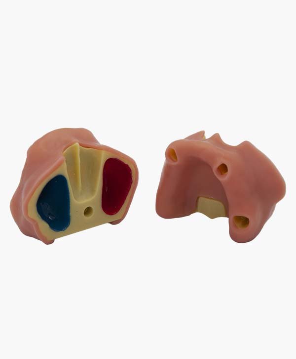 Maxillary Sinus Lifting Exercise A - Feiman